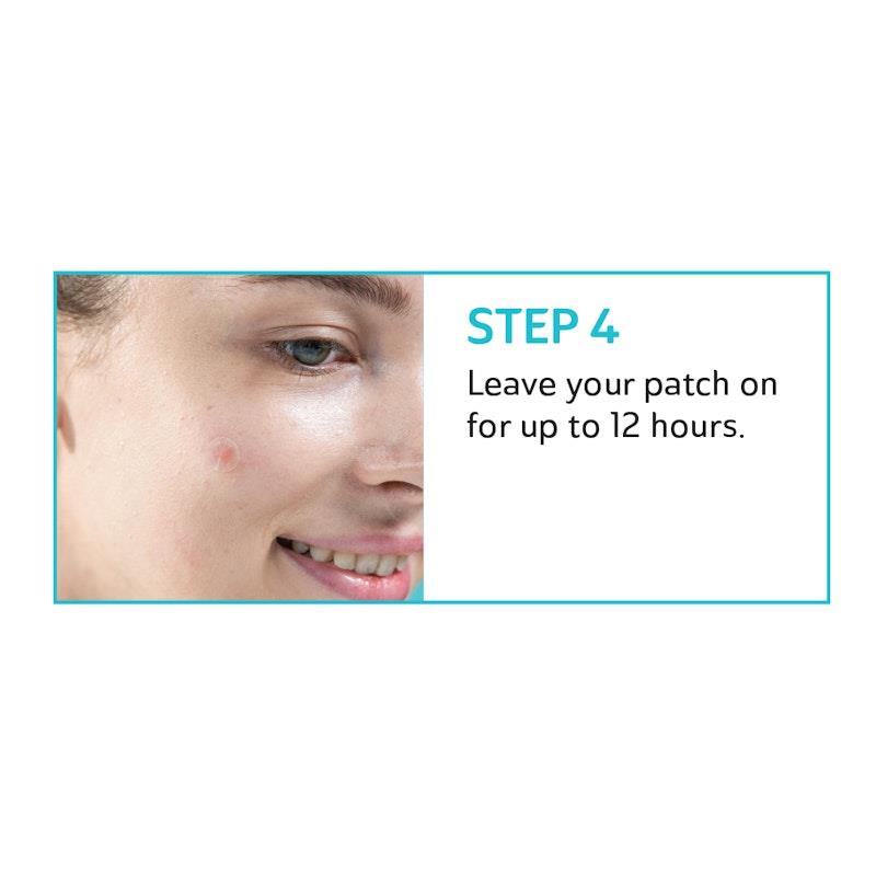 Buy DermaAngel Acne Day Patches 24 1Pack Online at Chemist Warehouse®