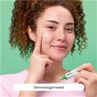 Buy Hero Mighty Rescue Balm Red Correct 15ml Online at Chemist Warehouse®